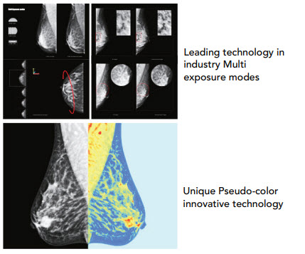ENDO MM2+Tomo | PT ENDO Indonesia