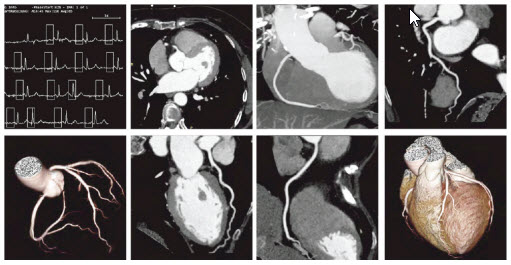 ENDO CS 64 | PT ENDO Indonesia